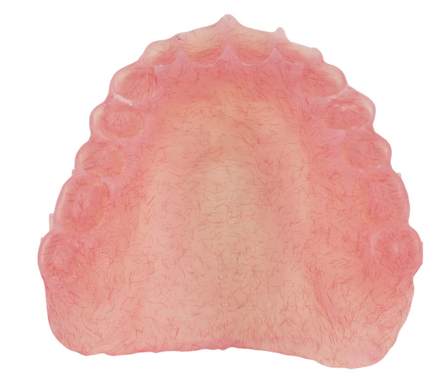 3D Printed Digital Dentures - Silcox Dental Supply